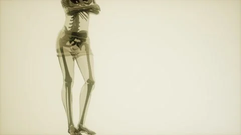 Human Skeleton Radiography Scan | Stock Video | Pond5
