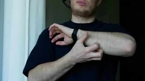 Human skin allergy, hand scratching, ins... | Stock Video | Pond5