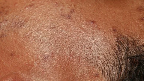 Human Skin Analysis | Stock Video | Pond5