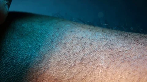 Human Skin Analysis | Stock Video | Pond5