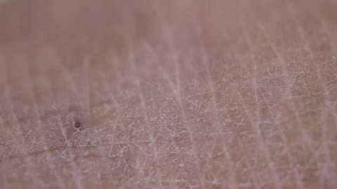 Human Skin Analysis | Stock Video | Pond5