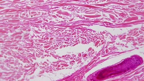 Human skin in section magnified under li... | Stock Video | Pond5