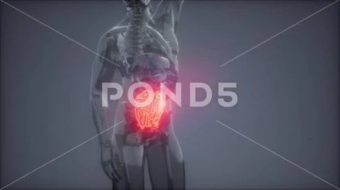 Human Small Intestine Radiology Exam science anatomy scan of human ...