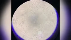 Sperm Microscope 40x