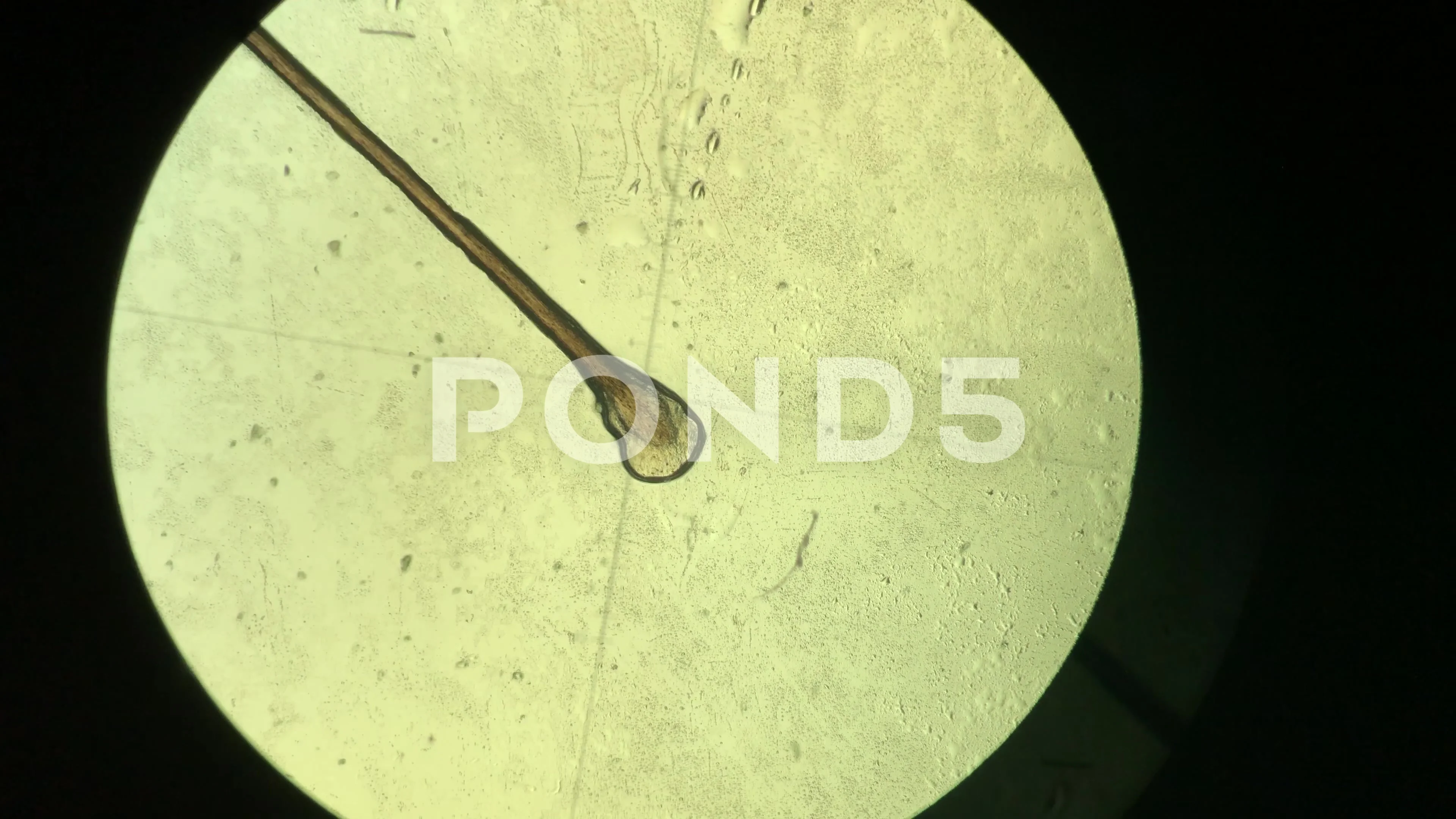 Yeast Cells Under Microscope 500x