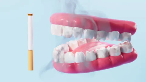 Human teeth and smoking, oral hygiene, 3... | Stock Video | Pond5