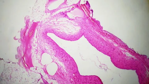 Human Vein specimen, multiple magnificat... | Stock Video | Pond5