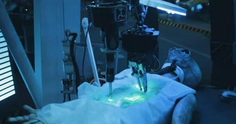 Surgery Abdomen Stock Video Footage | Royalty Free Surgery Abdomen ...