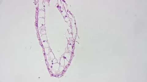 Hydra in transversal section under micro... | Stock Video | Pond5