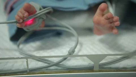 ICU ventilator in hospital baby feet mov... | Stock Video | Pond5