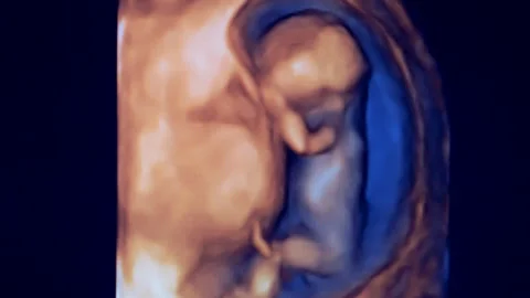 Image of a tiny human fetus in mother's ... | Stock Video | Pond5