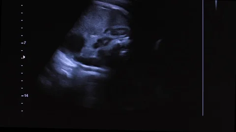 Unborn Baby In Womb Stock Footage ~ Royalty Free Stock Videos | Pond5