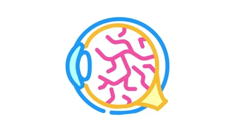 inflammation of eye ophthalmology color ... | Stock Video | Pond5