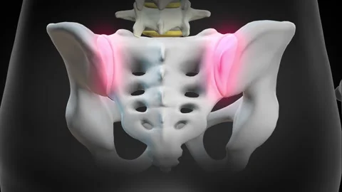 Sacroiliac Joint Stock Video Footage | Royalty Free Sacroiliac Joint ...