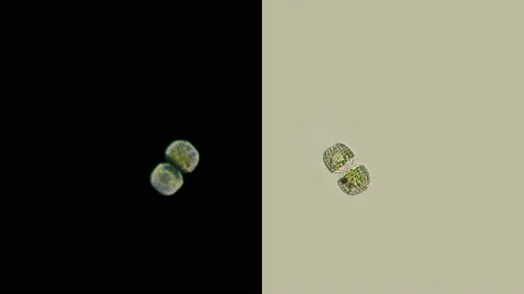 Infusoria Coleps under the microscope, f... | Stock Video | Pond5