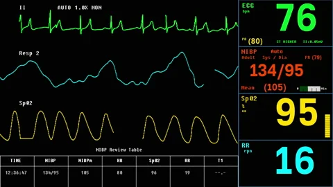 Interface Of ECG System Monitoring Healt... | Stock Video | Pond5