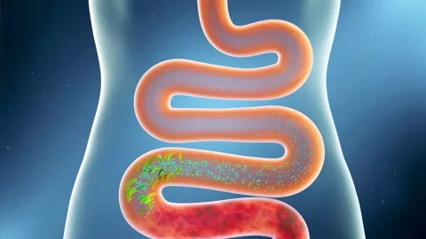 Intestinal probiotics clean up stool, pr... | Stock Video | Pond5