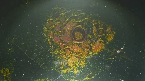 Intestine magnified under microscope 40x... | Stock Video | Pond5