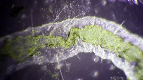 intestine of nematode under the microsco... | Stock Video | Pond5