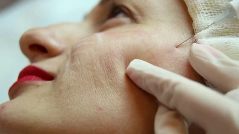 introduction of injection under the skin... | Stock Video | Pond5