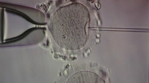 IVF, in vitro fertilisation through a mi... | Stock Video | Pond5
