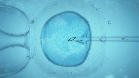Ivf, In Vitro Fertilisation Through A Mi... | Stock Video | Pond5