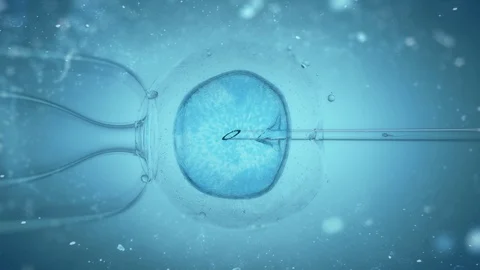 Ivf, In Vitro Fertilisation Through A Mi... | Stock Video | Pond5