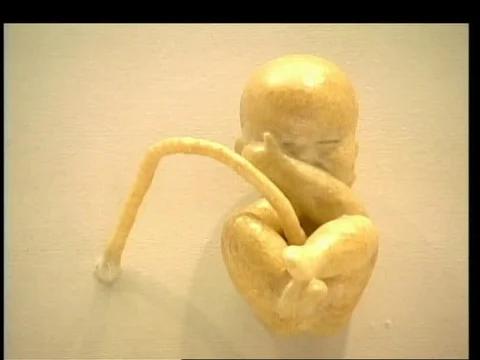 Hospital Runner Empty Stock Footage ~ Royalty Free Stock Videos | Pond5