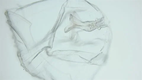 jellyfish phylum Cnidaria under a micros... | Stock Video | Pond5
