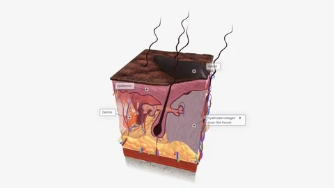 Keloid Scar Stock Video Footage | Royalty Free Keloid Scar Videos | Pond5