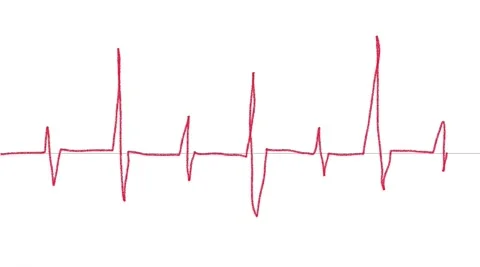 Kid drawing ECG heart signal with chalk | Stock Video | Pond5