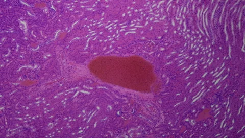 Kidney under the microscope, longitudina... | Stock Video | Pond5