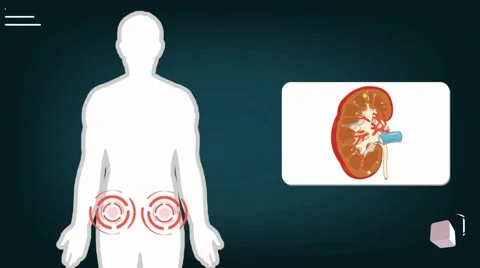 kidney - vector animation - analysis - b... | Stock Video | Pond5