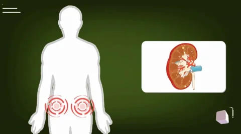 kidney - vector animation - analysis - g... | Stock Video | Pond5