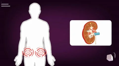 kidney - vector animation - analysis - p... | Stock Video | Pond5