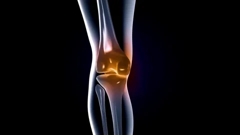 Medical Animation Knee Stock Footage ~ Royalty Free Stock Videos | Pond5
