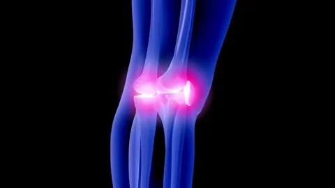Medical Animation Knee Stock Footage ~ Royalty Free Stock Videos | Pond5