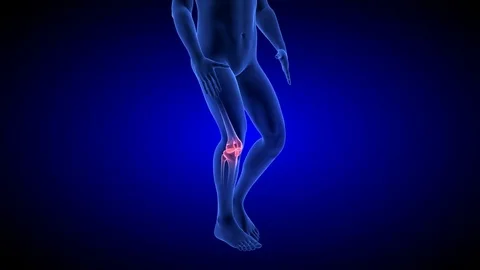 Knee Pain animation. Blue Human Anatomy ... | Stock Video | Pond5