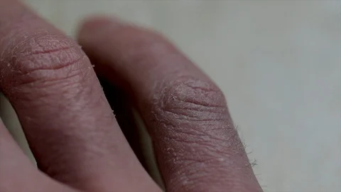 Dermatologist Stock Footage ~ Royalty Free Stock Videos | Pond5