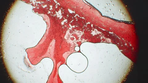 Lab analysis of blood under a microscope... | Stock Video | Pond5