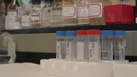 Lab tubes in cancer research lab | Stock Video | Pond5