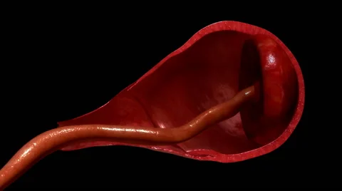 Labor and vaginal birth | Stock Video | Pond5