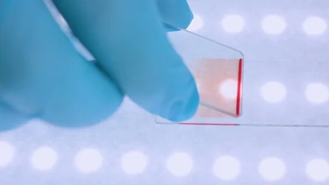 Blood Drop Analysis Stock Video Footage | Royalty Free Blood Drop ...