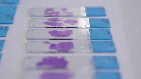laboratory microscope samples on a glass... | Stock Video | Pond5
