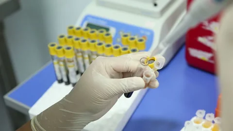 Blood Pouring Stock Videos – Royalty-Free HD & 4K Videos | Pond5