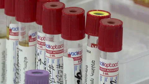 Blood Pouring Stock Footage ~ Royalty Free Stock Videos | Pond5