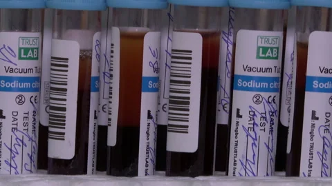 Blood Pouring Stock Footage ~ Royalty Free Stock Videos | Pond5