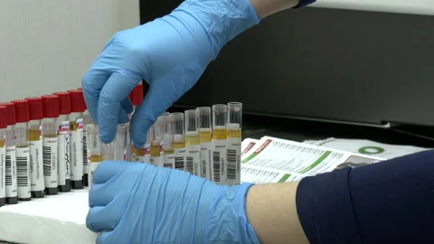 Blood Pouring Stock Footage ~ Royalty Free Stock Videos | Pond5