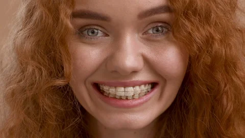 Lady With Braces Smiling Snapping Teeth ... | Stock Video | Pond5