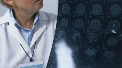 Lady doctor showing brain X-ray and shak... | Stock Video | Pond5
